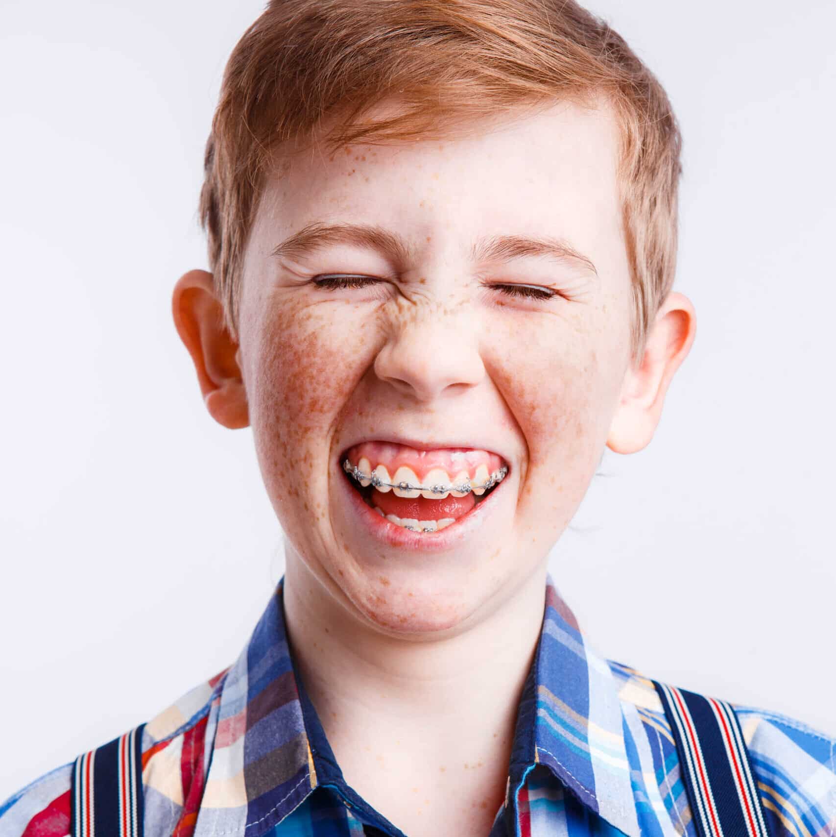 Can a Root Canal on Baby Teeth Affect Future Orthodontic Results? What ...